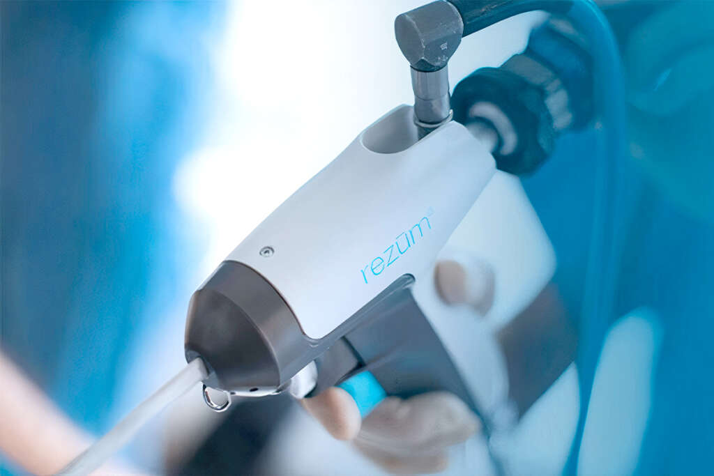 Terapia térmica con vapor de agua - Centro Argentino de Urología